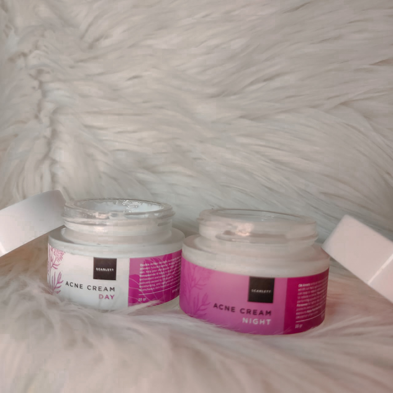 Review Acne Cream Day dan Acne Cream Night Scarlet - Black Girl