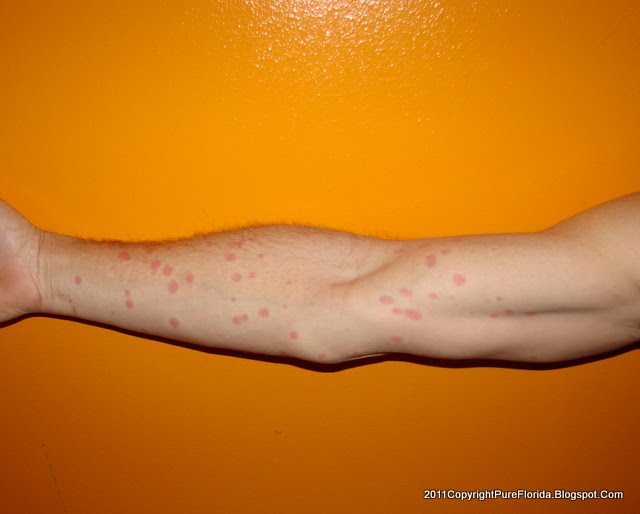 PURE FLORIDA: Sand Gnats And A Rant