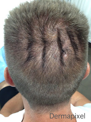 Dermapixel: enero 2021