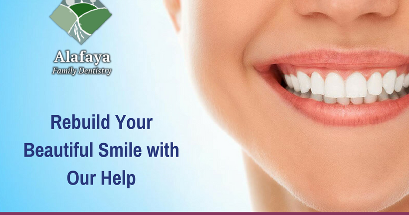 Rebuild Your Beautiful Smile with Our Help