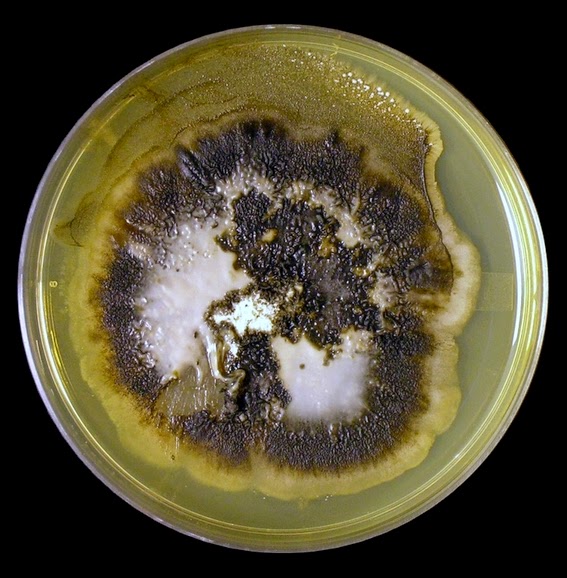 Fun With Microbiology (What's Buggin' You?): Aureobasidium pullans