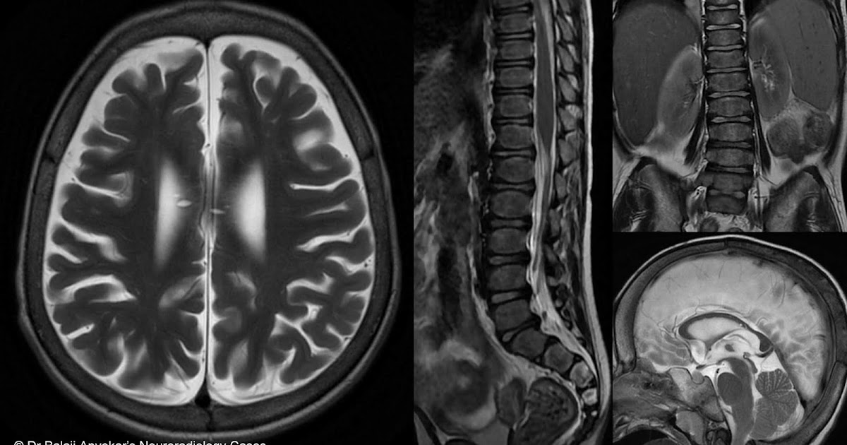 Dr Balaji Anvekar FRCR: MPS MRI