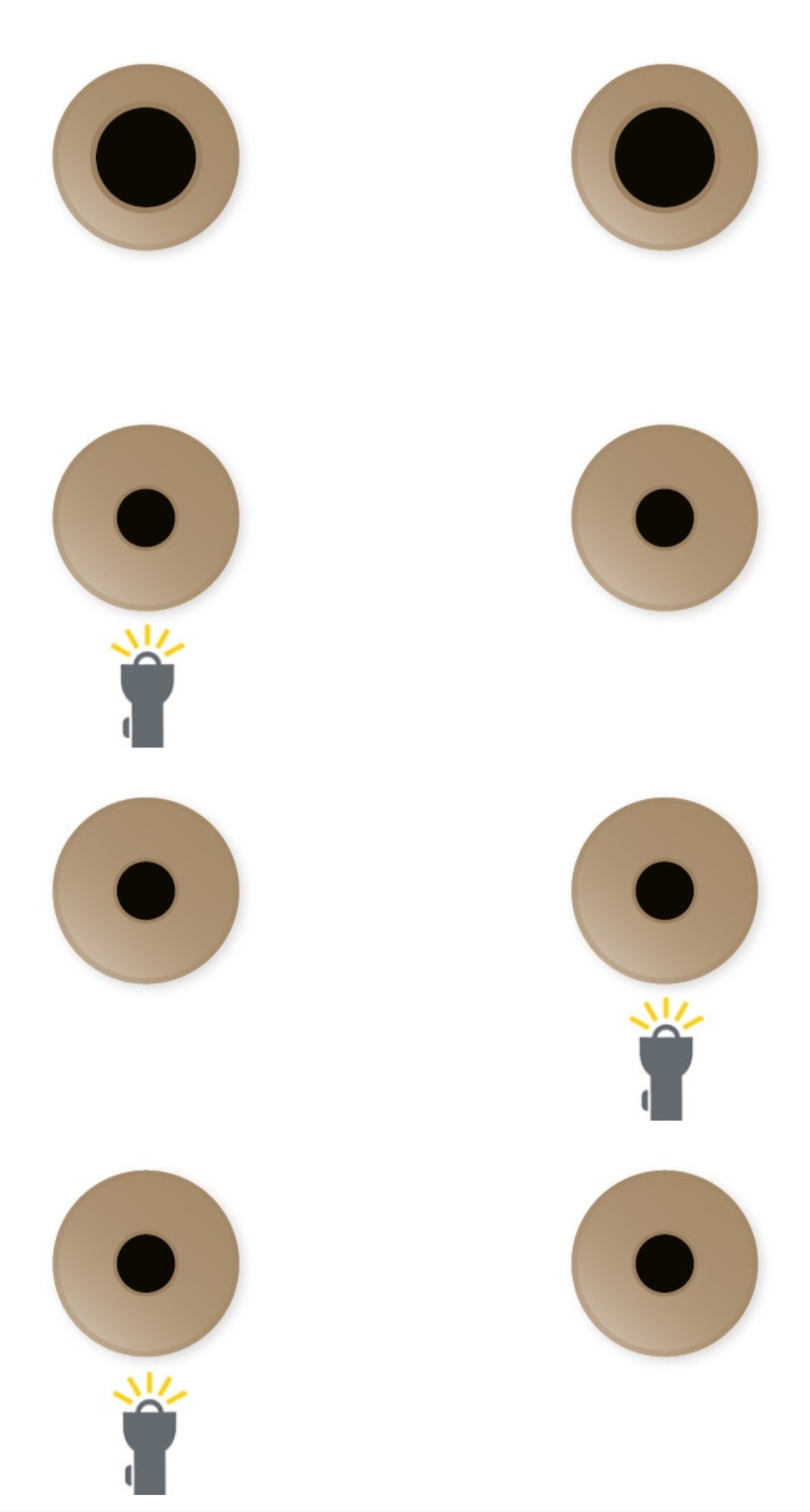 Common causes of RAPD