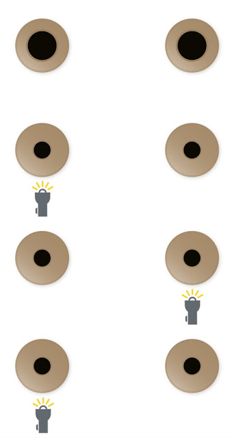 Common causes of RAPD