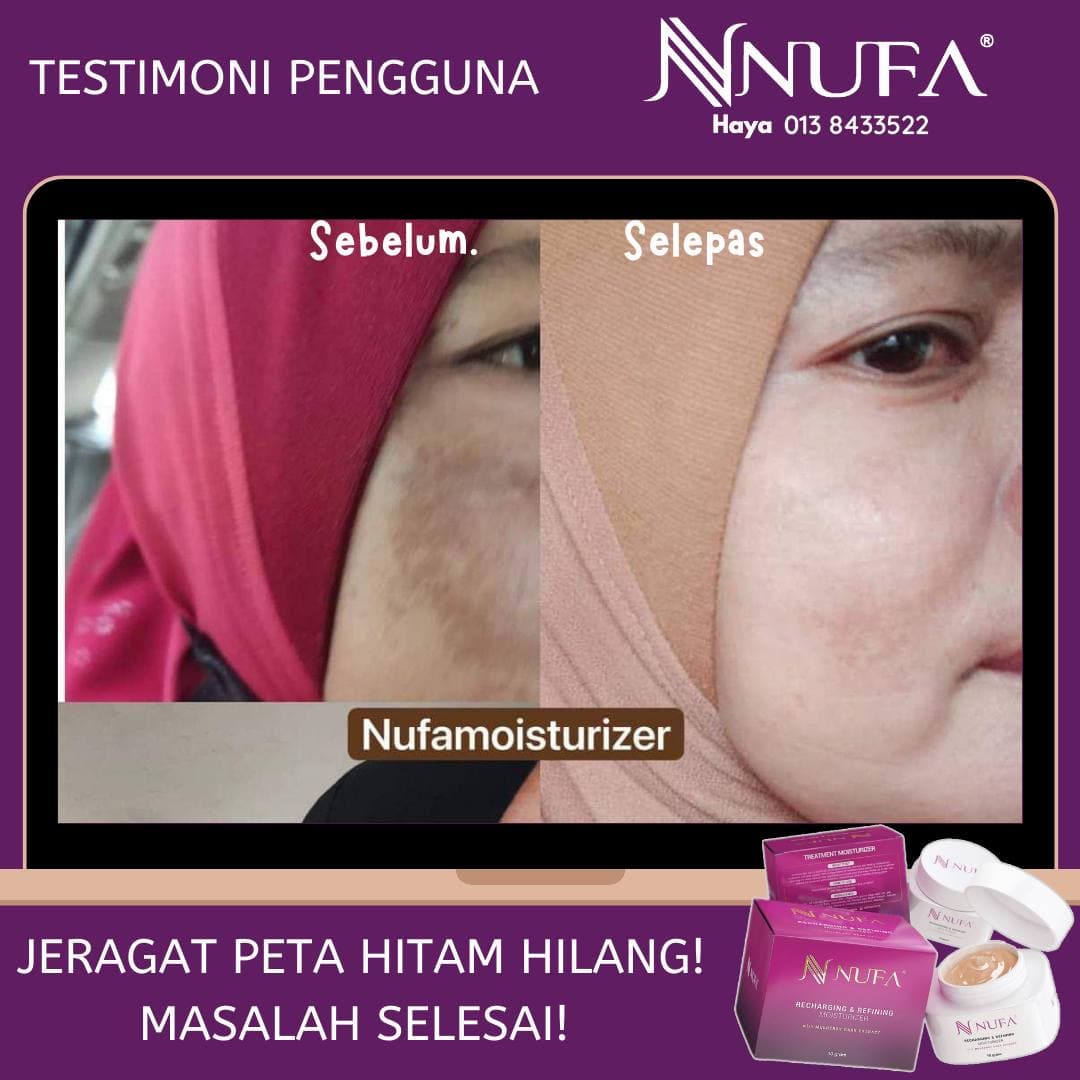 Nufa Treatment Moisturizer Krim Jeragat