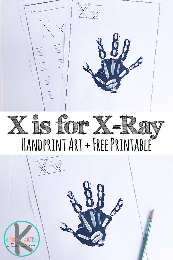 Kindergarten Worksheets And Games Letter X Worksheets Xray Hand Art kindergarten-worksheets-and-games-letter-x-worksheets-xray-hand-art