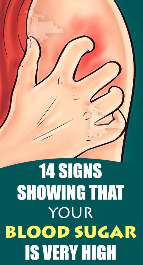14 Signs Showing That Your Blood Sugar Is Very High - NATURAL HEALTH