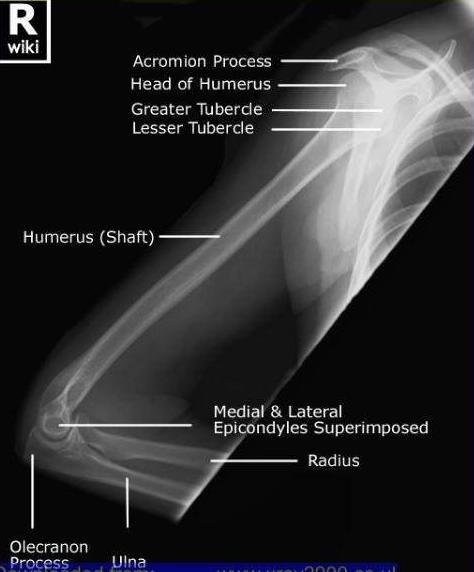 Assalamu Alaikum...: TEKNIK RADIOGRAFI EKSTREMITAS SUPERIOR