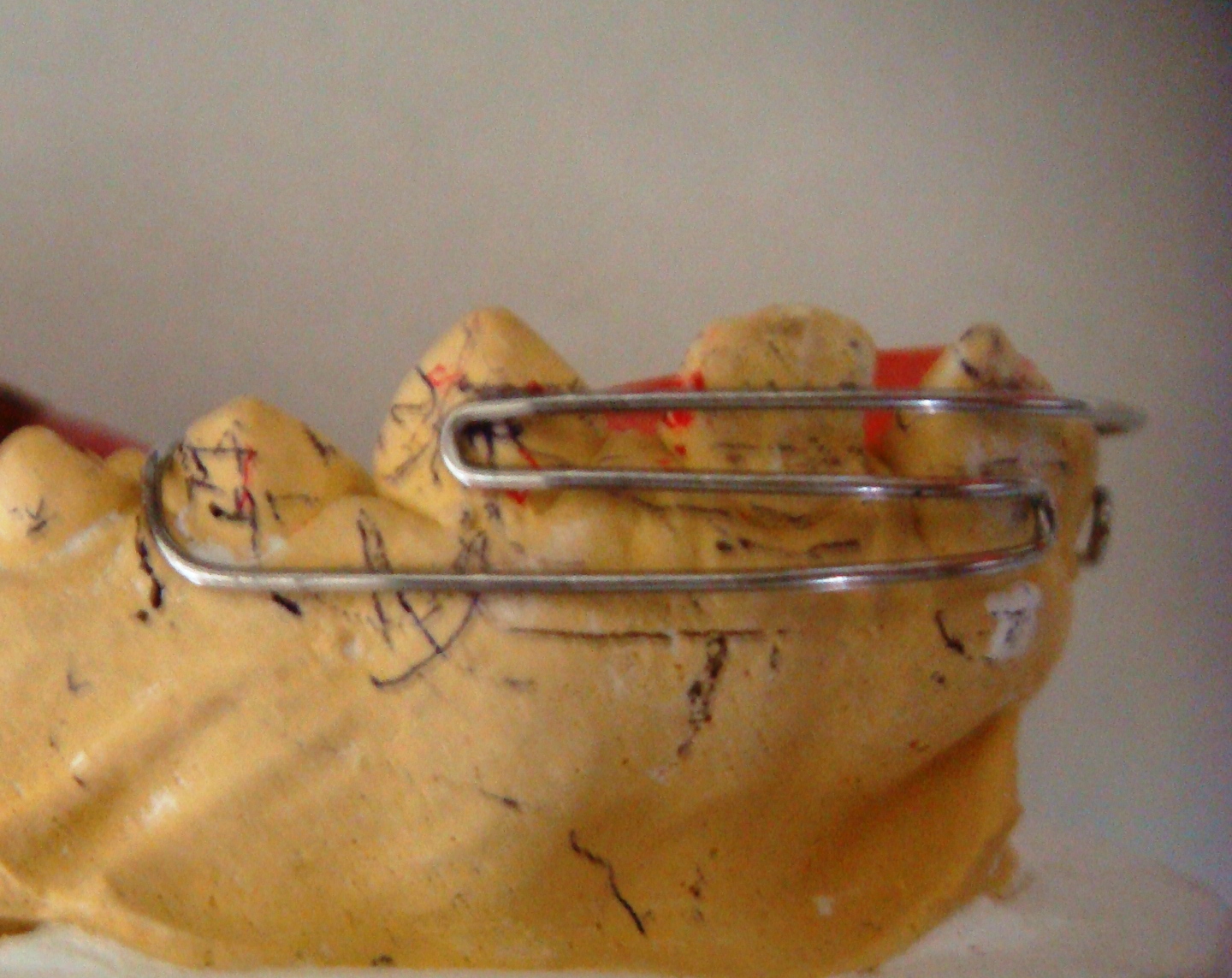 Dentistry lectures for MFDS/MJDF/NBDE/ORE: A Note on Active Components ...