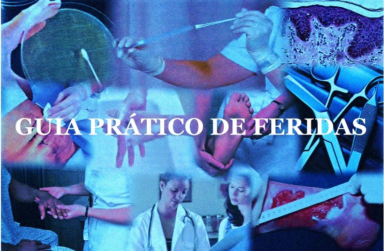 Guia Prático de Feridas : FERIDAS CIRÚRGICAS