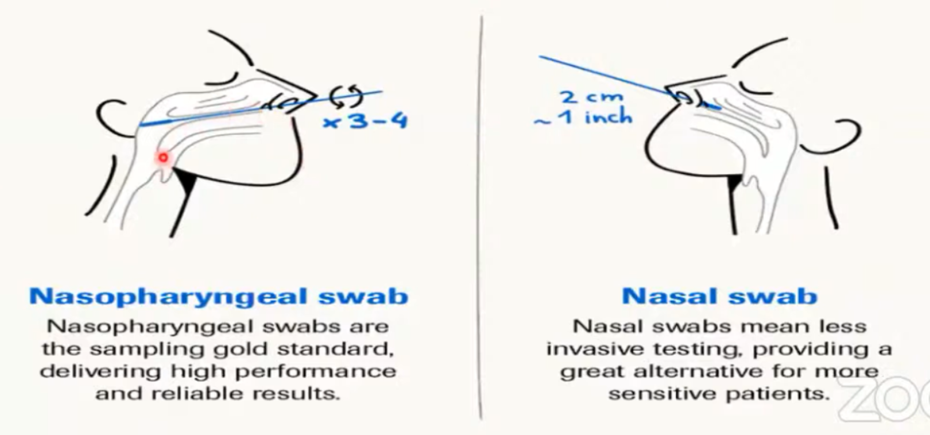 Nasofaringeal Swab atau Nasal Swab?