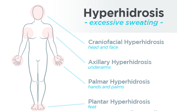 Hyperhidrosis – Definition, Complications, and Treatment. - The Thesis