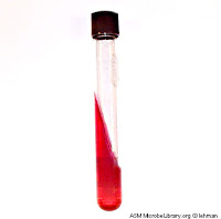 Media Triple Sugar Iron Agar (TSIA) ~ Medical Laboratory Technologist