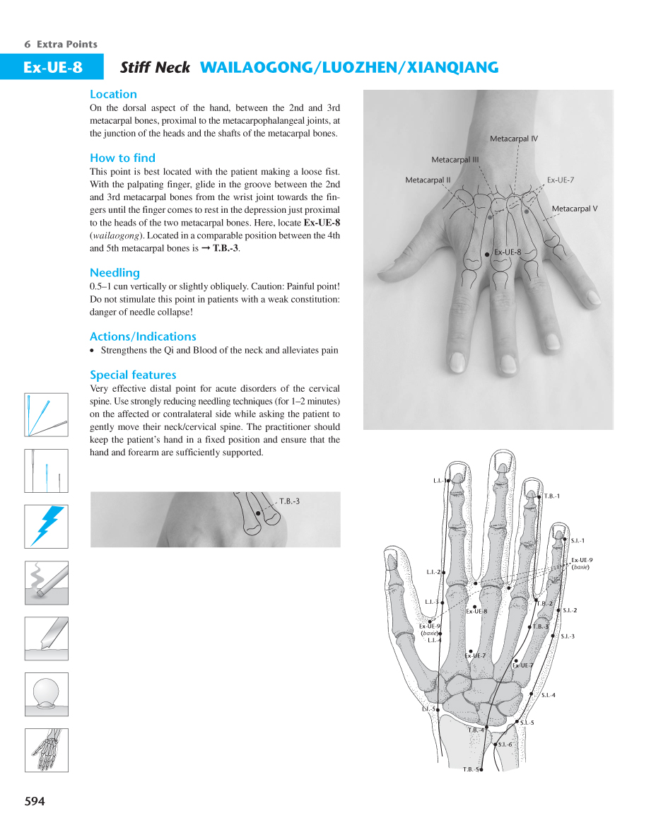 Acupuncture Masters: Acupuncture Points Database - Extra Points