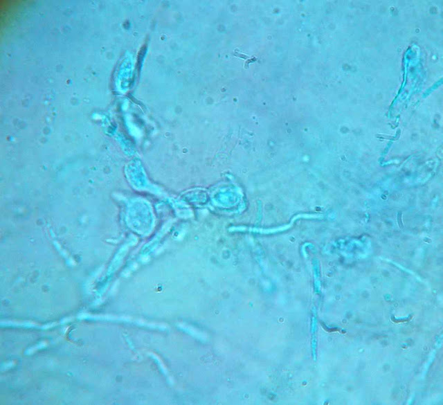 ATLAS MICOLOGIA: EPIDERMOPHYTON FLOCCOSUM