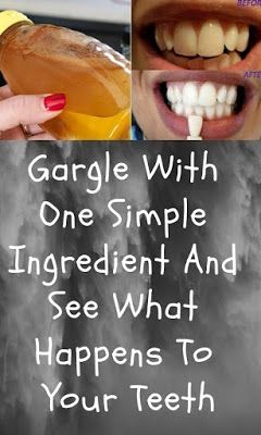 GARGLE WITH ONE SIMPLE INGREDIENT AND SEE WHAT HAPPEN TO YOUR TEETH ...