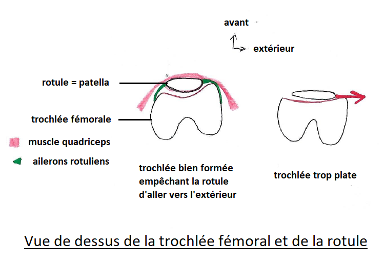 Luxation et sub luxation de la rotule