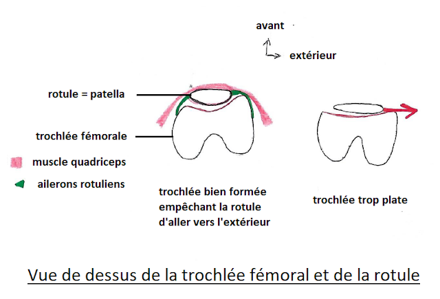 Luxation et sub luxation de la rotule