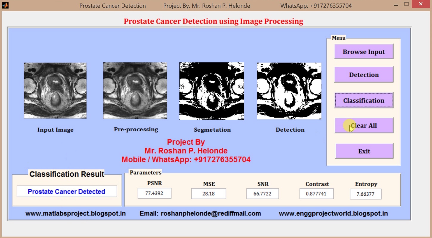 Matlab Code For Prostate Cancer Detection Using Image