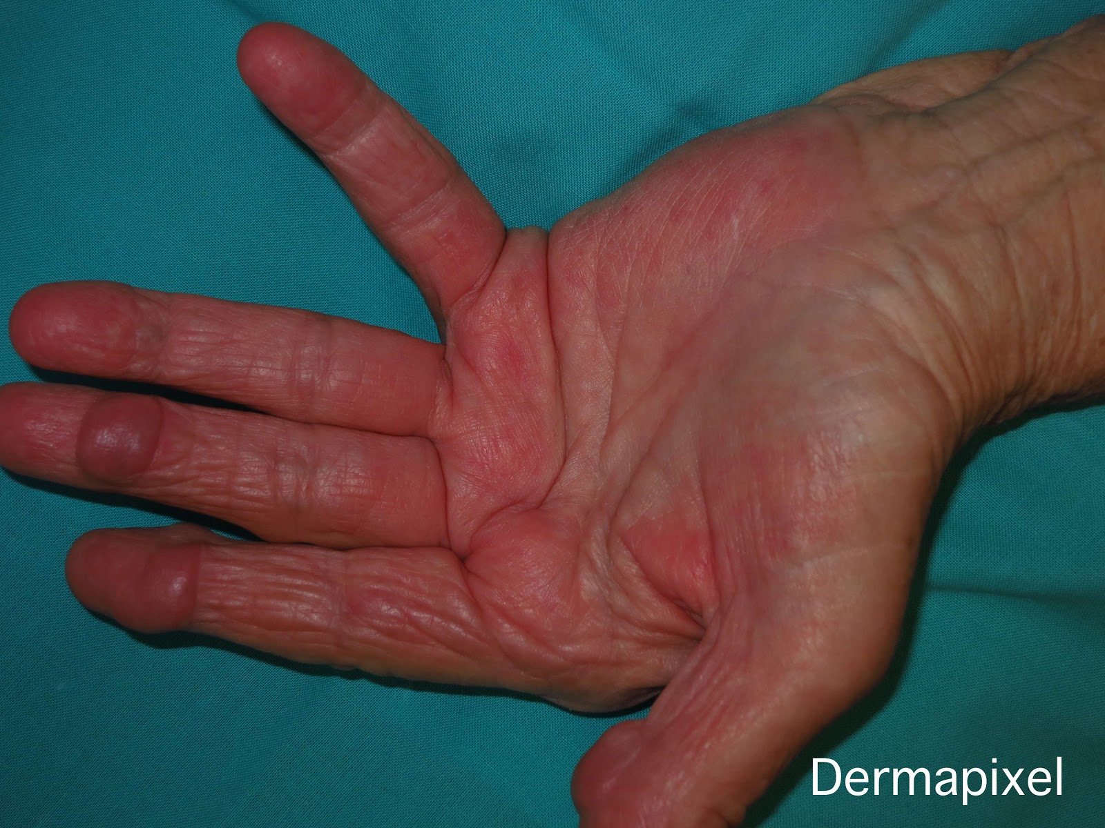 Dermapixel: diciembre 2019