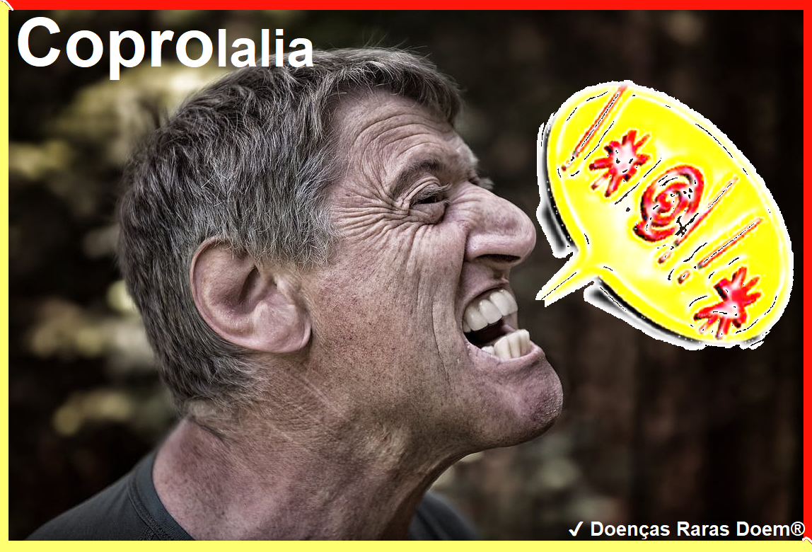 Doenças Raras Doem®: Coprolalia