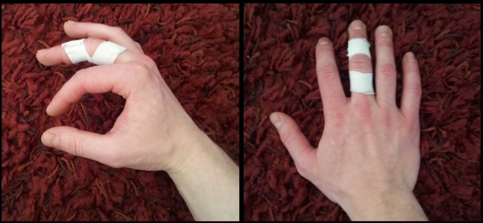 Chicago Climber: Pully Problems.