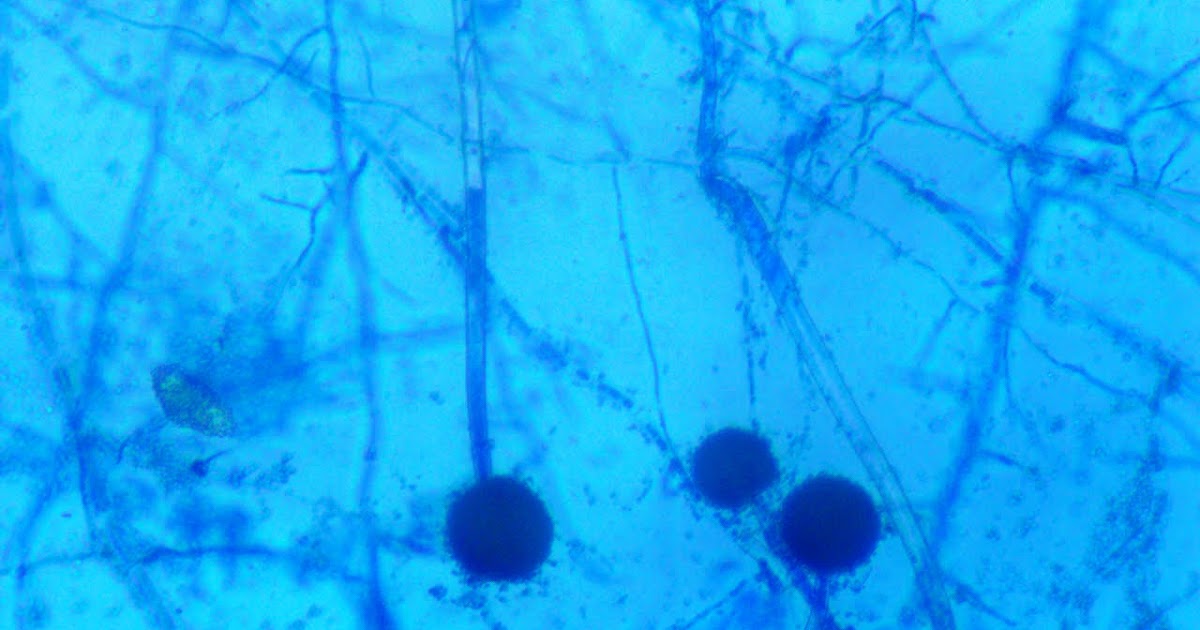 Ram Micro Arena : LACTOPHENOL COTTON BLUE METHOD