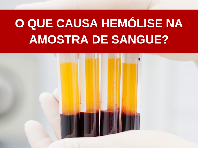 O que causa hemólise na amostra de sangue? - Tira o Jaleco