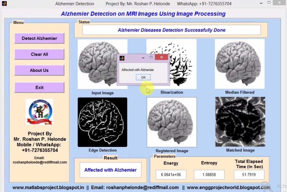 Alzheimer Detection Using Matlab Project Code Ieee Based Project ~ Low Price Projects