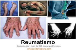 É um conjunto de doenças que possuem origem não traumática, ou seja ...