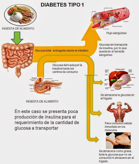 Centro de Especialidades Médicas MEDISOCIAL: DIABETES TIPO 1