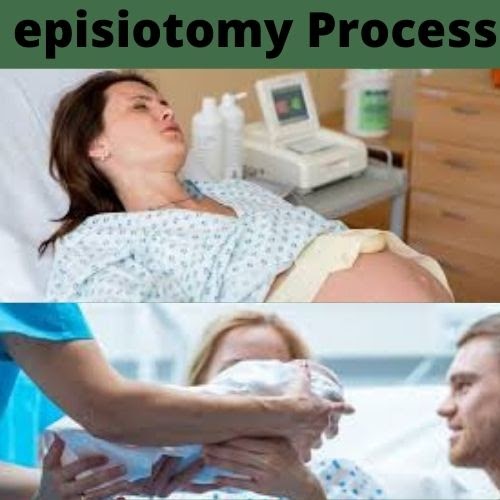 What is episiotomy and when it,s need? OR How to baby birth ...