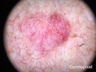 Dermapixel: mayo 2021