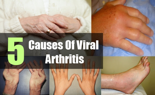 DIABETE AWARENESS &TOTAL WELLNESS PACK