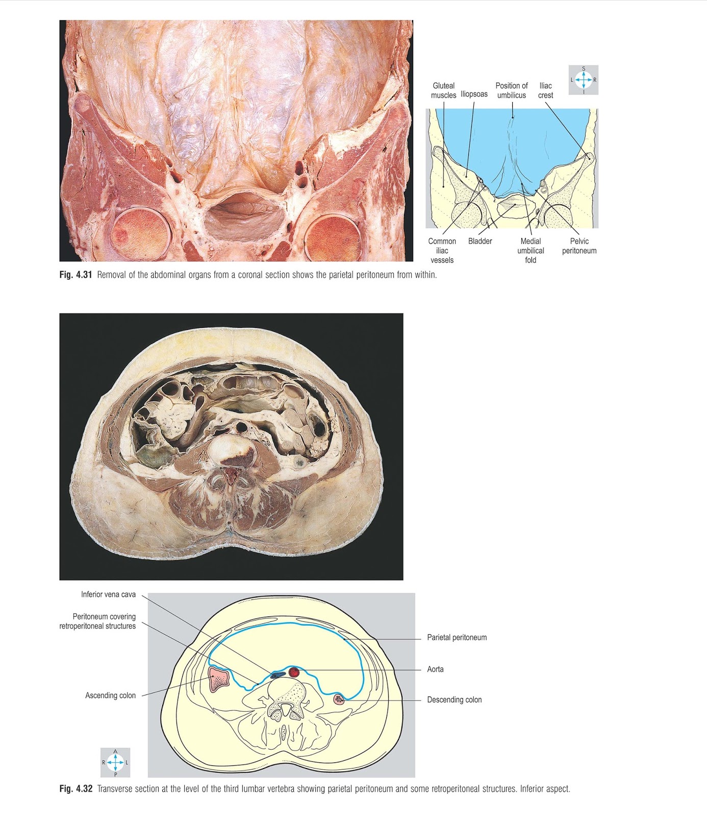 Peritoneum Anatomy - pediagenosis