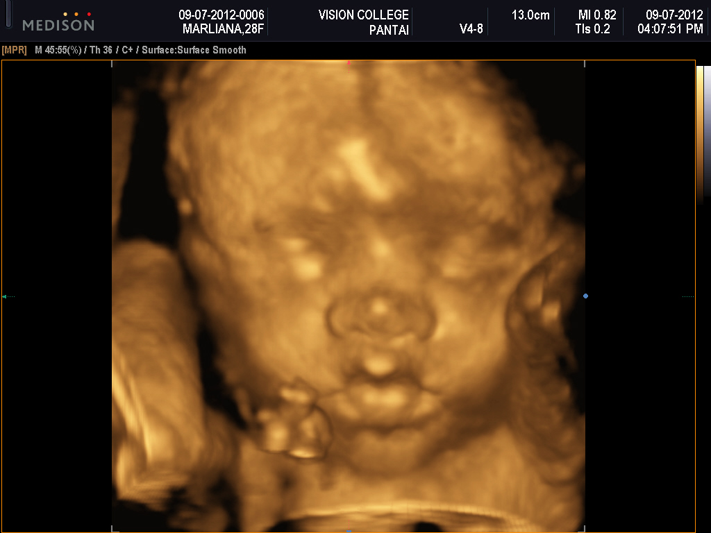 My Simple but Nice Life: 3D/ 4D Scan Baby Scan - 26 Weeks Di Vision College