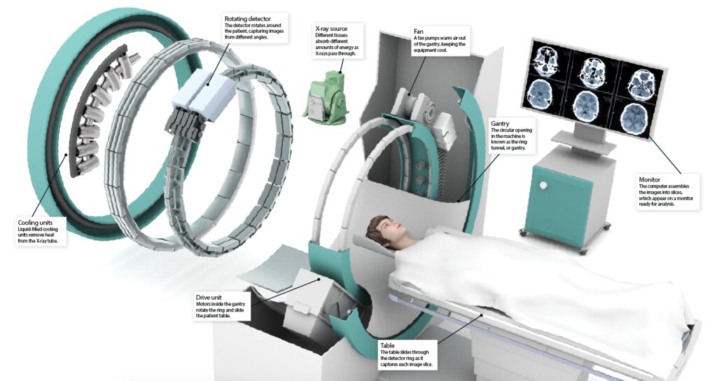 Cara Kerja Computerised Tomography CT Scanner