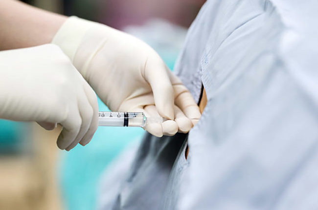 Nerve Block Cpt Code