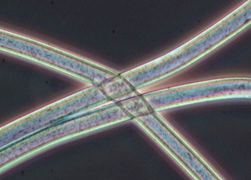 Forensics: Forensics Project Part II: Hair and Fiber Analysis Forensics: Forensics Project Part II: Hair and Fiber Analysis