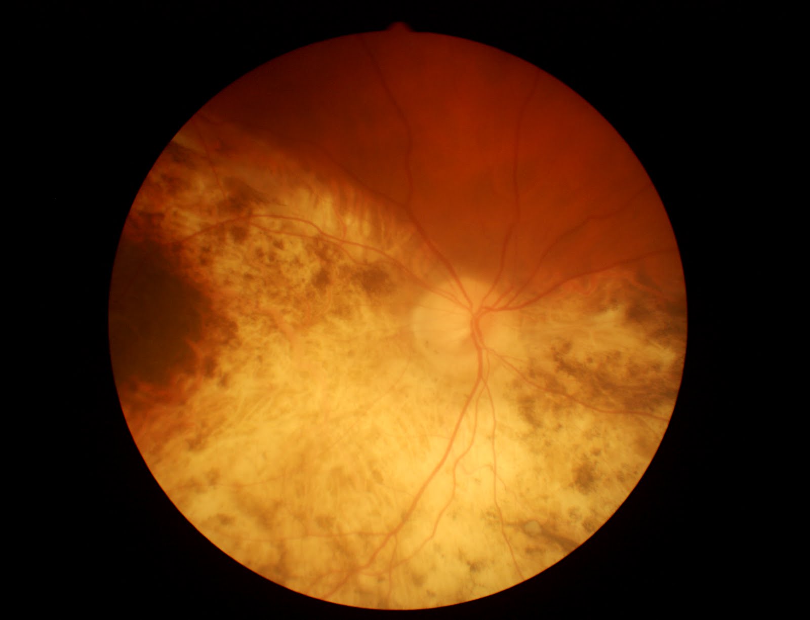 RichmondOptometry.com: Retinal photo of the year