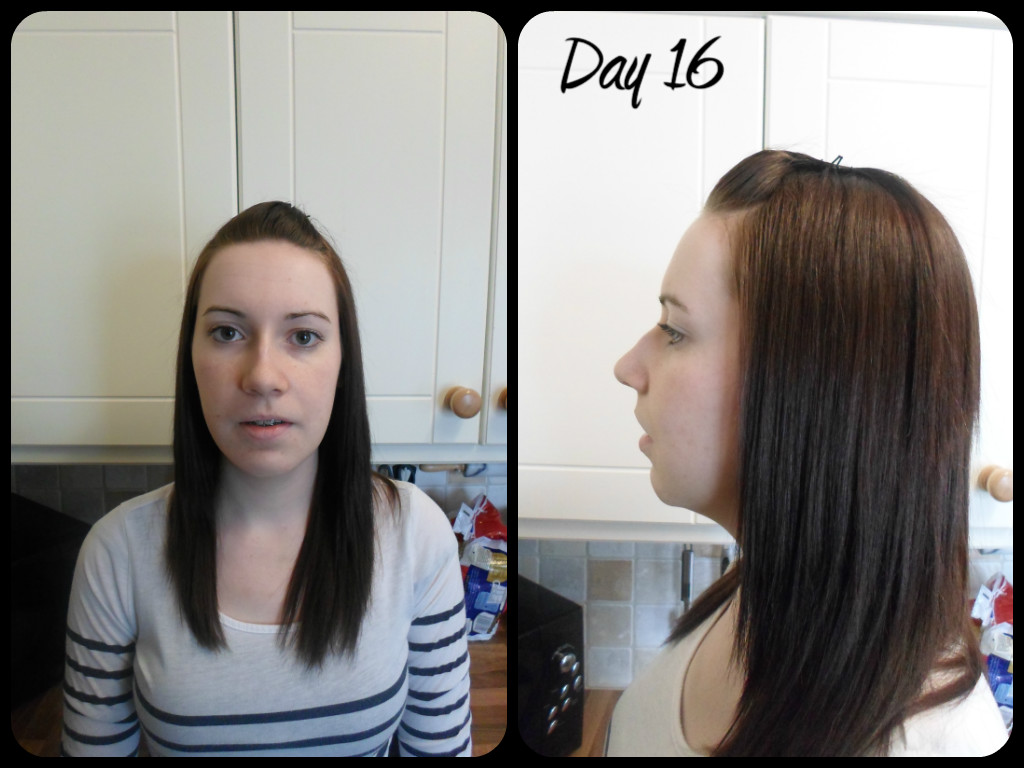 My jaw surgery and I..: Day 16: Cotton ball cheeks