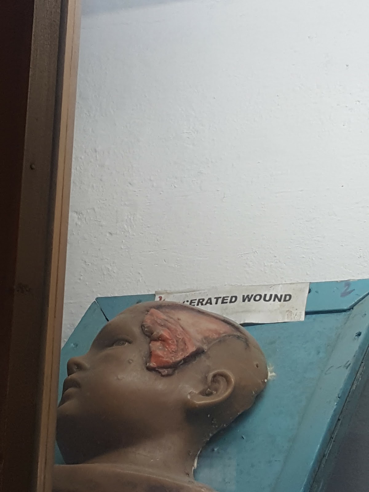 Forensic museum models and specimens (upadated 2016)