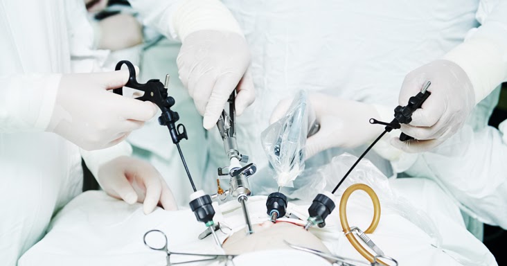 Fungsi Laparoscopy Pada Alat Kesehatan - FUNGSI ALAT