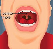 Robbie Vocal: A voz do Axl Rose