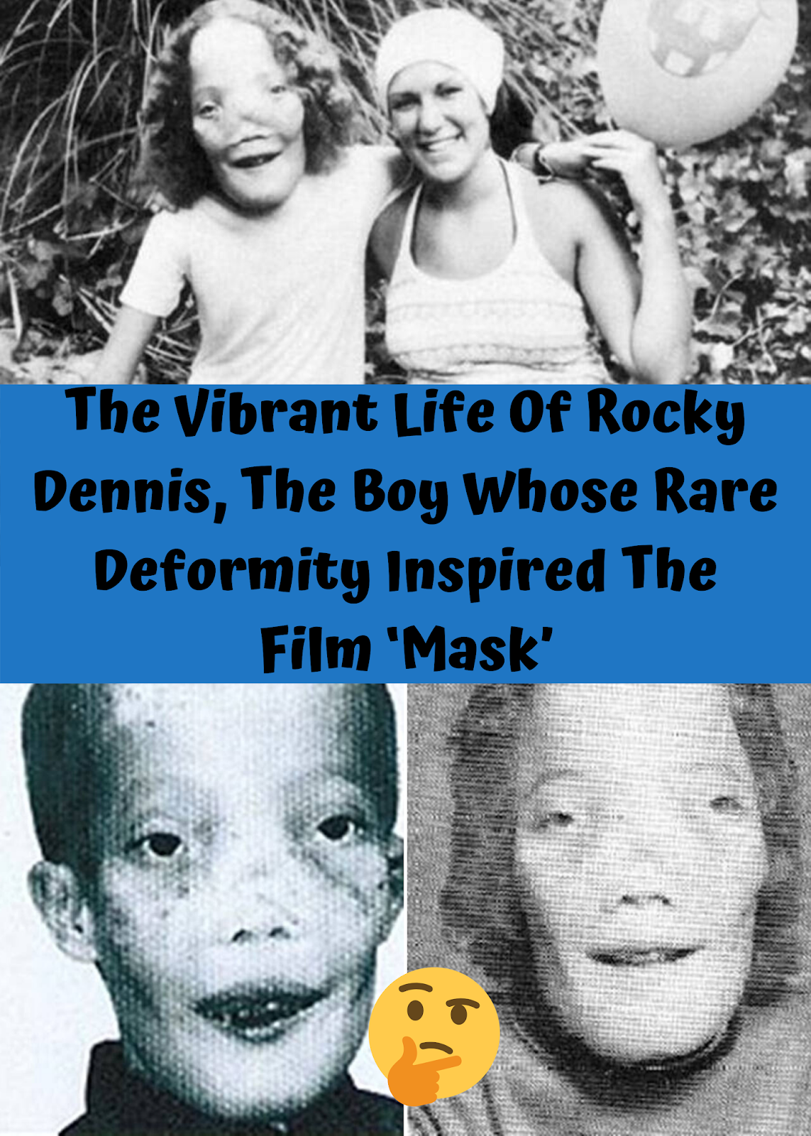 The Vibrant Life Of Rocky Dennis, The Boy Whose Rare Deformity Inspired ...