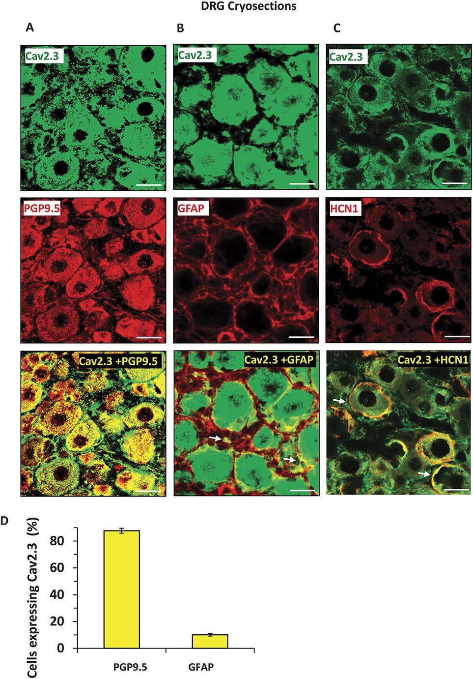 Neuromics: Neuronal Markers