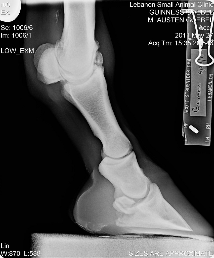 5 Years, 2 Bad Joints, 1 Long Journey