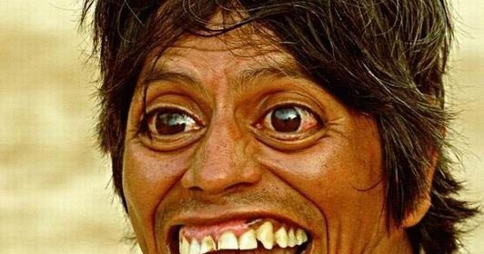 Fotos das 10 Pessoas mas Feias Do mundo >> Mini Sol