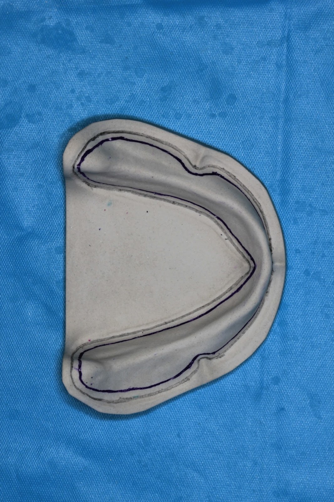 Understanding Prosthodontics - Tagore Dental College & Hospital-By ...