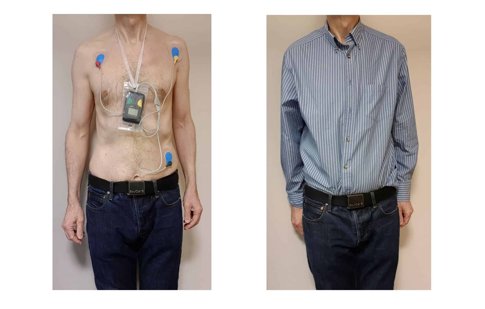 The Site for Healthcare Professionals: ECG (Electrocardiogram).